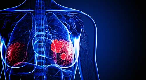 Primus Ray Laboratories